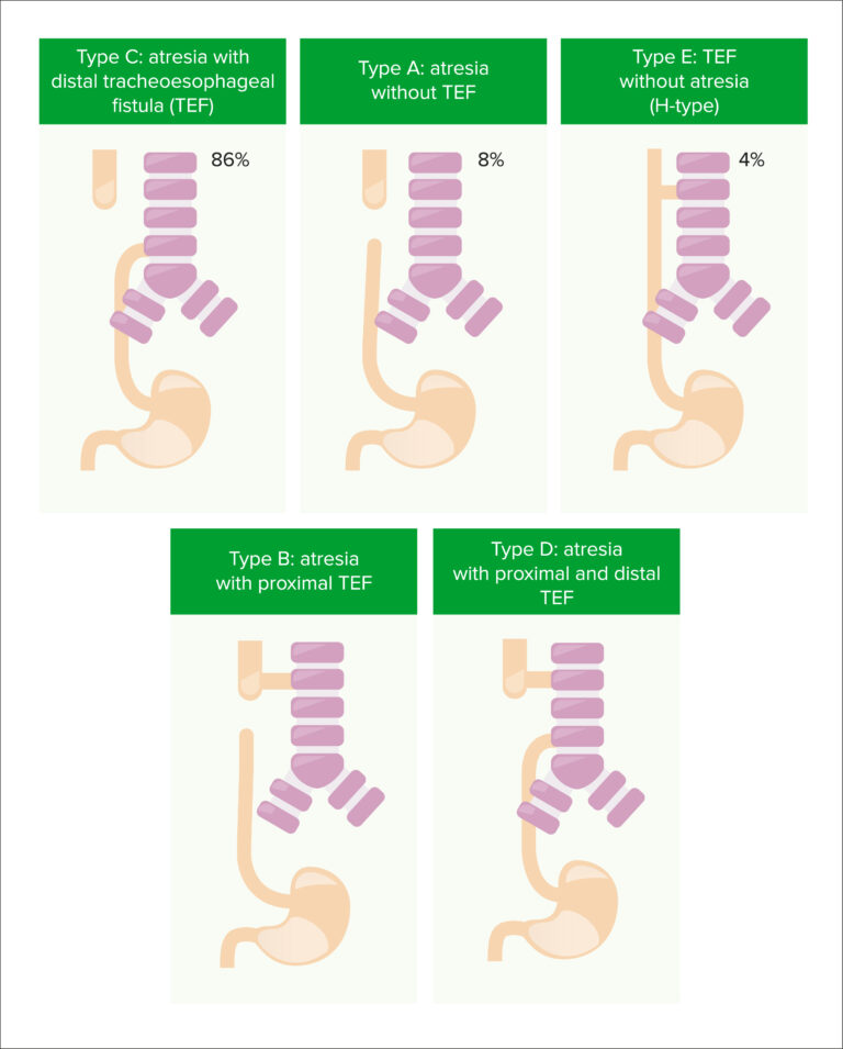 Desarrollo del Sistema Respiratorio | Concise Medical Knowledge