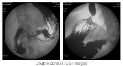 Imaging of the Intestines | Concise Medical Knowledge