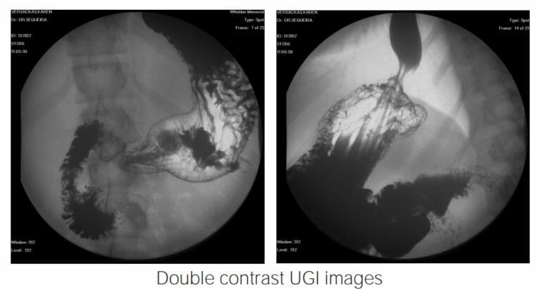 Imagenología Intestinal | Concise Medical Knowledge
