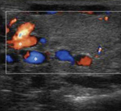 Scrotal Imaging | Concise Medical Knowledge