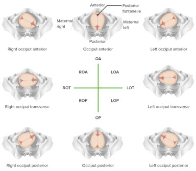 Fetal Malpresentation and Malposition | Concise Medical Knowledge