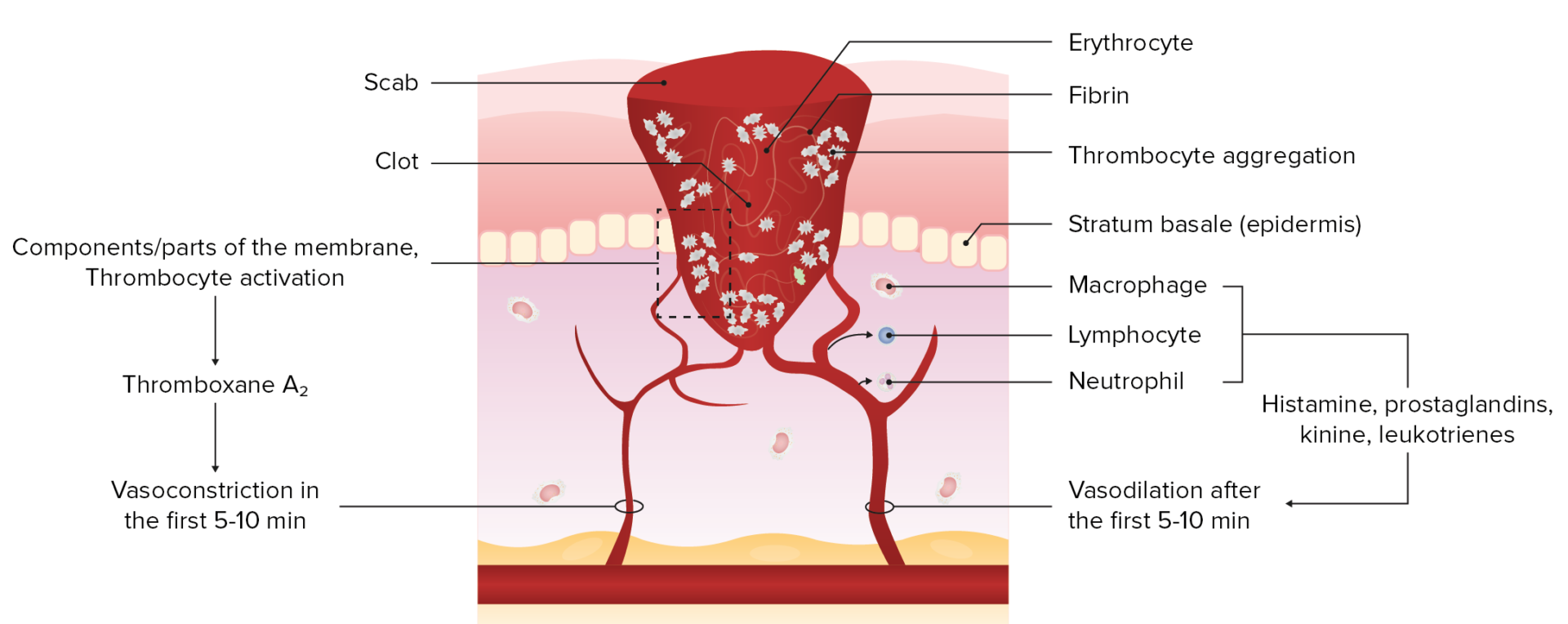 Cicatrização de Feridas | Concise Medical Knowledge
