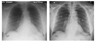 X-rays | Concise Medical Knowledge