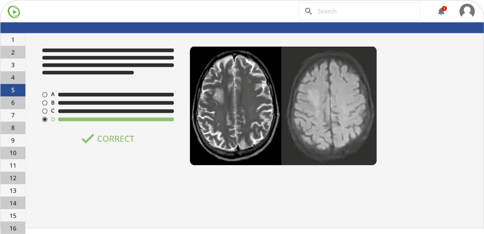 Prepare for the PANCE | Lecturio Medical