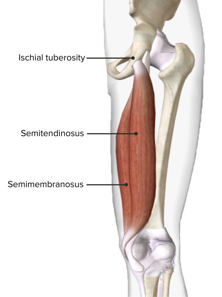 Coxa | Concise Medical Knowledge