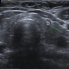 Ultrasonido (Ecografía) | Concise Medical Knowledge